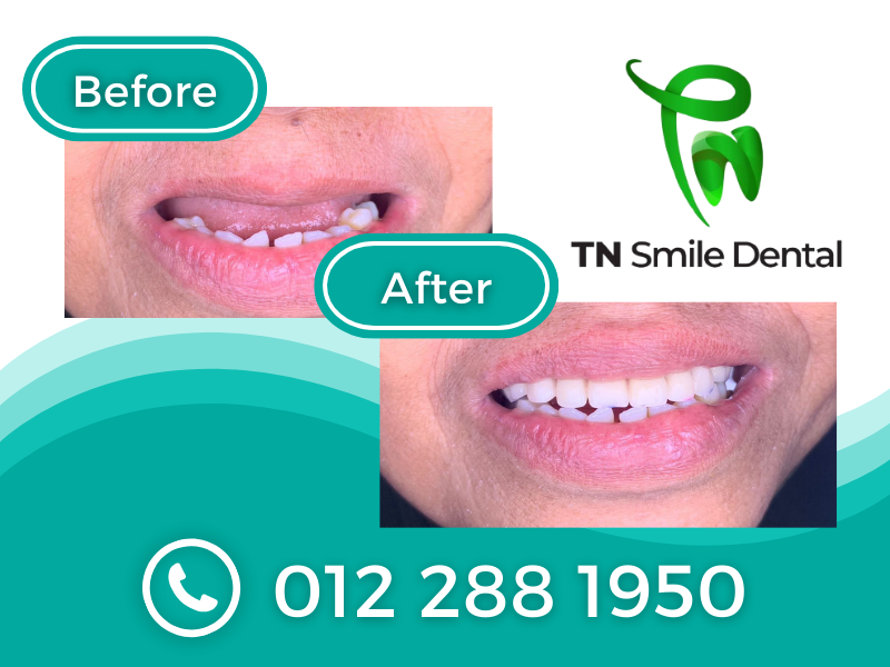 TN Smile Dental | Melaka2U